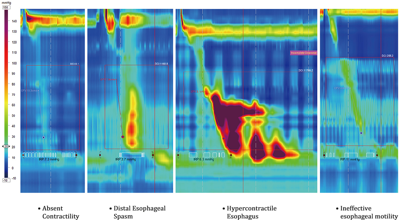 High Resolution Manometry System_JINSHAN